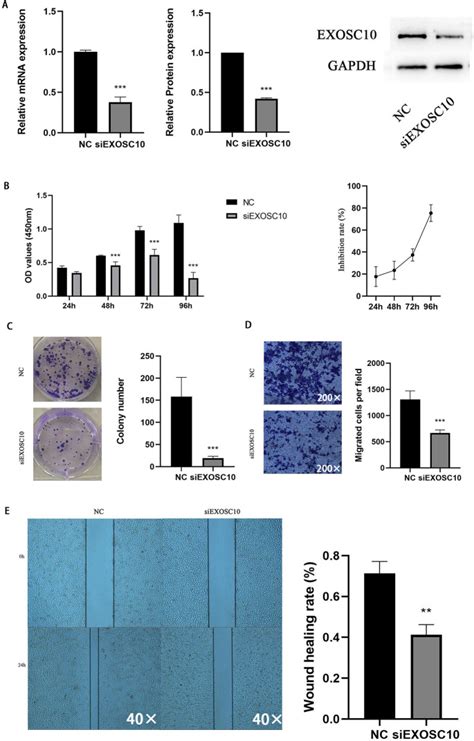 Exosc10 Is A Novel Hepatocellular Carcinoma Prognostic Biomarker A
