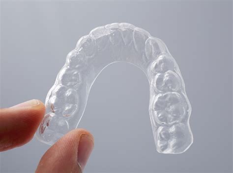 The Ultimate Guide To Orthodontic Retainers Clear Dental Retainers