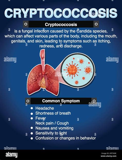 Informative Poster Of Cryptococcosis Illustration Stock Vector Image And Art Alamy