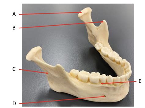 Mandible Bone Anterolateral View Diagram Quizlet