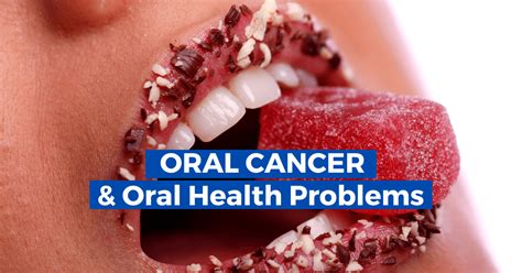 Oral Health Problems Can Cause More Oral Cancer Risks