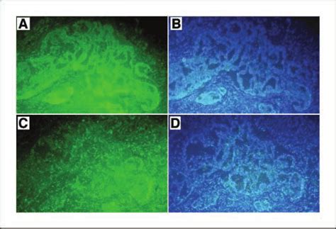 In Situ Zymography Of Endometrial Carcinoma Tissues Serial Frozen