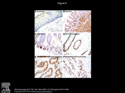 Volume 138 Issue 5 Pages E2 May 2010 Ppt Download