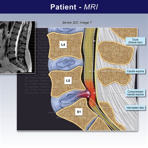 Mri Colorization Trialexhibits Inc