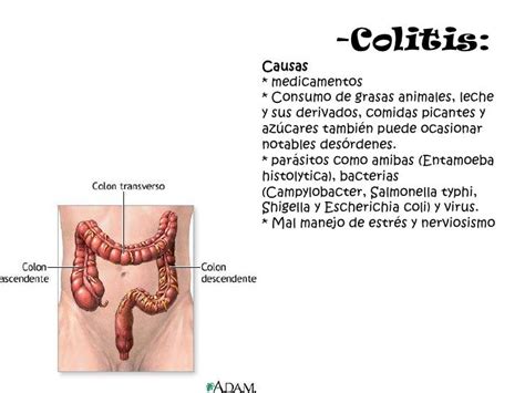 Xochitlndc Naturalmente Sanos Tipos De Colitis