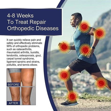 Advanced Joint And Bone Therapy Bee Venom Gelbee Venom Joint And Bone