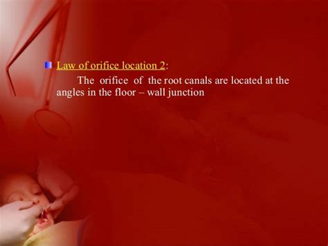 Locating Root Canal Orifice In Molar Rct