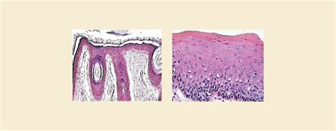 Epithelial Nonkeratinized Stratified Squamous Cell Stratified Squamous