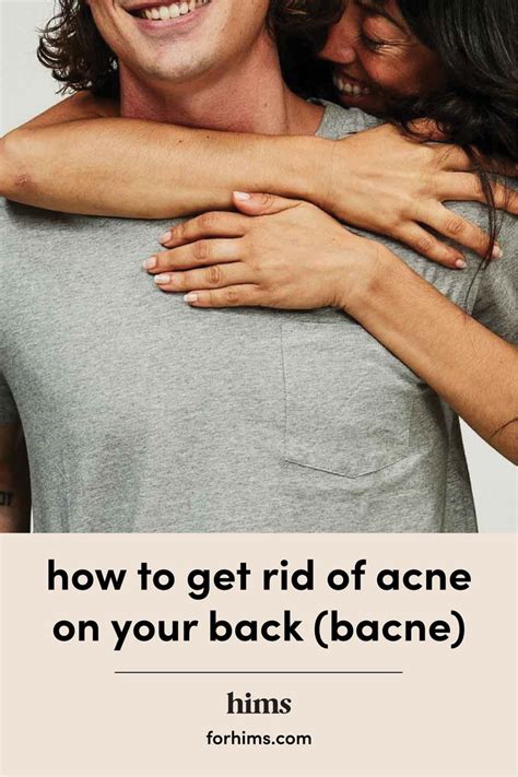 All About Back Acne Bacne Hims Bacne How To Get Rid Of Acne Acne