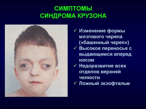 Врожденные синдромы Врожденные кисты и свищи шеи Дермоидные кисты Клиника диагностика и