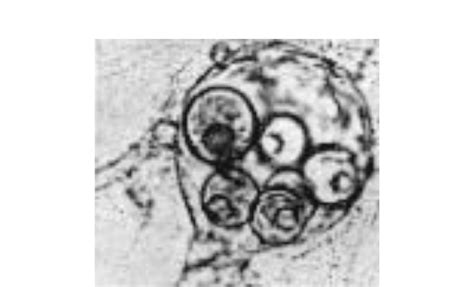Achlya Proliferoides Sex Organs At Control Showing Eccentric Oospores