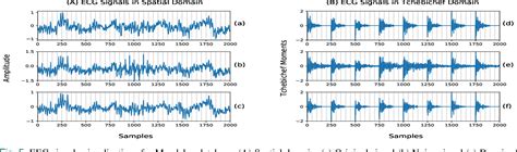 figure 5 from orthogonal features based eeg signals denoising using