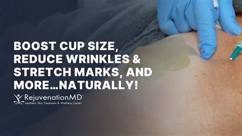 Enhance And Lift Breasts Naturally With Prp Youtube