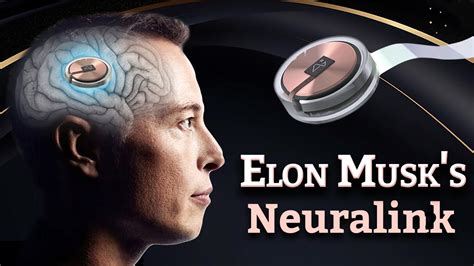 Elon Musks Neuralink Brain Chip Implants In First Human