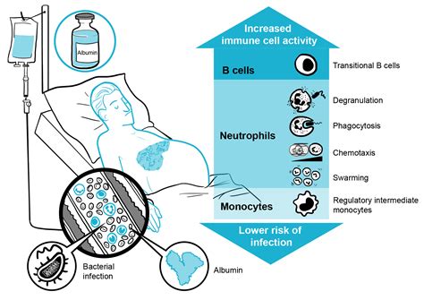 Albumin Boosts Immune System Function In Patients With Decompensated