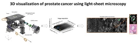 3d Visualization Of Prostate Cancer Using Light Sheet Microscopy Escience Institute