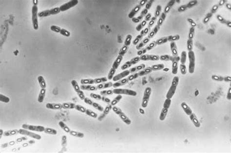 Gli Argomenti Spaziano Bacillus Thuringiensis Batterio Aerobio