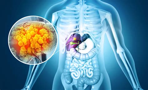 What Are 4 Warning Signs Of A Damaged Liver Illinois Recovery Center
