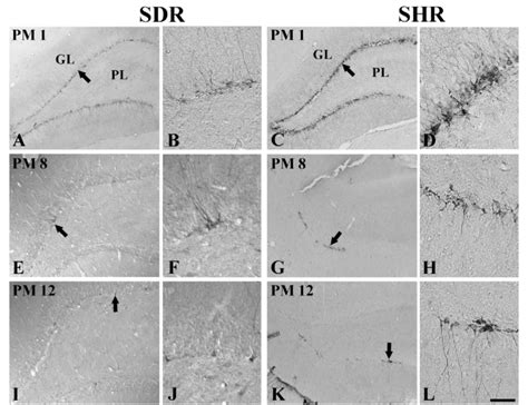 Microphotographs Of Dcx Immunoreactivity In The Dentate Gyrus In The