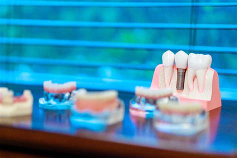 Office Tour Naperville Il • Wheaton Oral Surgery