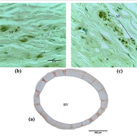 Attachment Of The Fibrous Capsule To The Glenoid Labrum At 11oclock Download Scientific