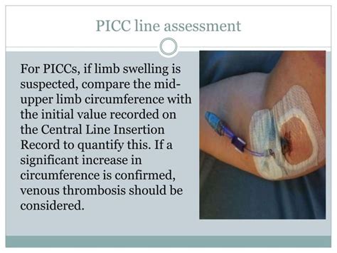 Care Of Patient With PICC Line And Central Pptx First Aid Injuries