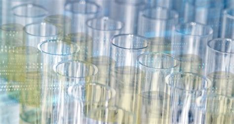 Is There A Need For Urinalysis Validation Software