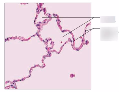 Simple Squamous Epithelium Diagram Quizlet