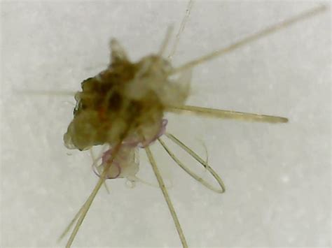 Bugs Living On My Scalp R Whatsthisbug