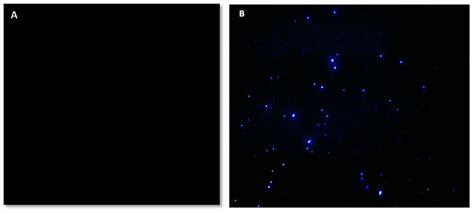 Ijms Free Full Text Lung Cancer Cell Derived Exosome Detection