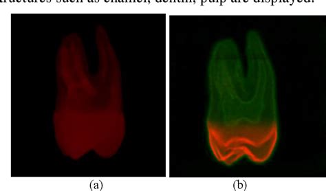 figure 5 from volume rendering transfer function design based on