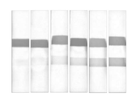 Fig S4 The Physical Map Of Lateral Flow Biosensors For The Detection Download Scientific