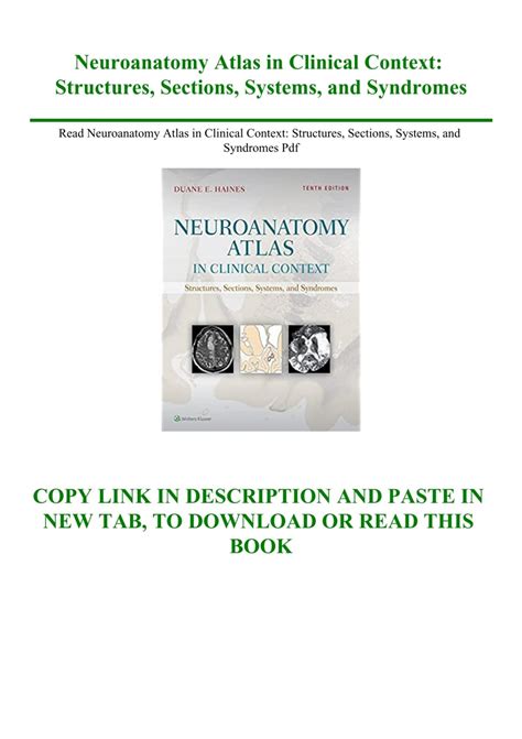 Read Neuroanatomy Atlas In Clinical Context Structures Sections Systems