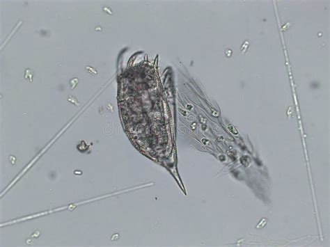 Freshwater Aquatic Zooplankton And Algae Under Microscope View Stock