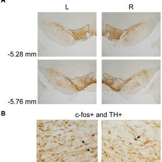 Example Of C Fos Labelings Of Dopaminergic Neurons In The VTA A