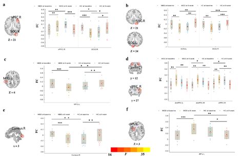 Group × Time Interaction On The Striatal Subregions Based Rsfc 2a
