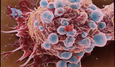 En Busca Del Talón De Aquiles Del Cáncer De Mama Más Agresivo Ciencia