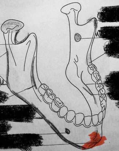 Maxillary And Mandibular Injection Sites Flashcards Quizlet