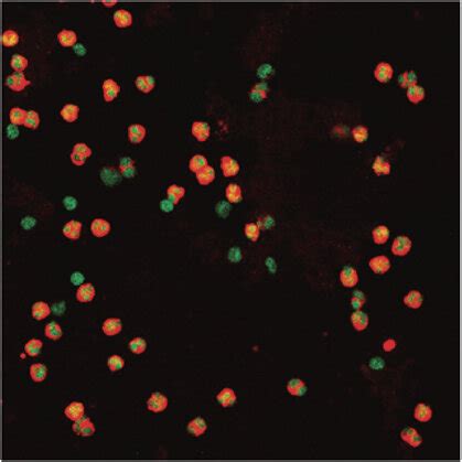 Phospho PDGFR Expression In Peripheral Blood Leukocytes By