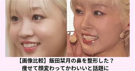 【画像比較】飯田栞月の鼻を整形した？痩せて顔変わってかわいいと話題に