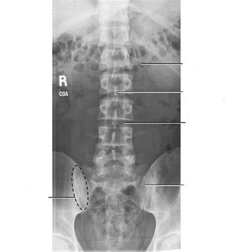 Ap L Spine Labeling Diagram Quizlet