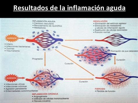 Inflamacion