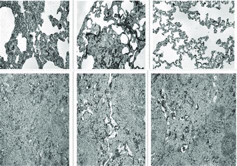 Distribution Of Fox3 Gata3 And T Bet Expression In Lung And Spleen Of