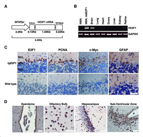 Molecular Characterization Of The Gfap E2f1 Transgenic Mouse Model A