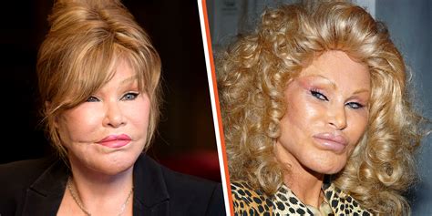 Jocelyn Wildenstein New Face 2024