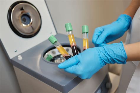 Apa Itu Prp Ovarium Fungsi Prosedur Dan Efeknya