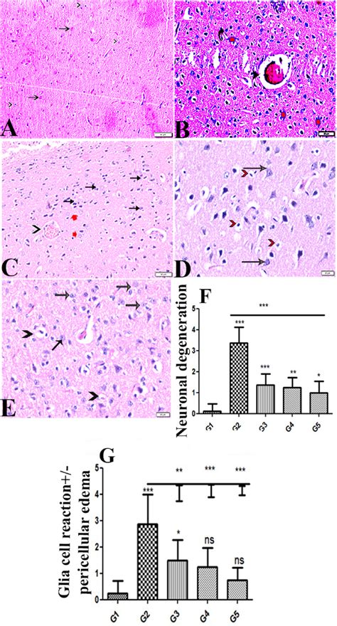 Photomicrograph Of Brain Tissue Sections From Mice Of Experimental