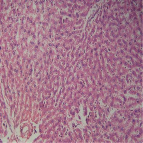 A Representative Section Of Rat Liver Administered Alcohol 25