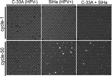 Detection Of Hpv 16 E6 In Negative Cells Positive Cells And