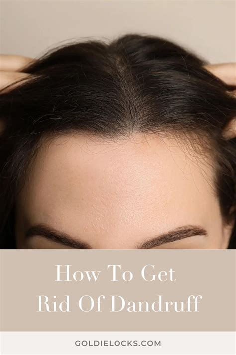 How To Get Rid Of Dandruff Hair Growing Tips Getting Rid Of Dandruff